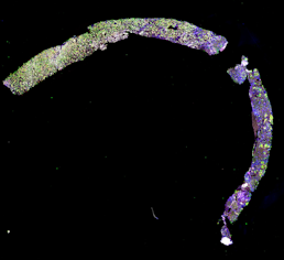 Atlases | Harvard Tissue Atlas